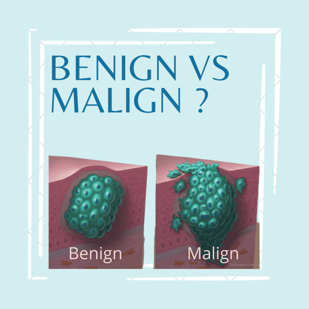 Tumora Benignă vs Malignă - e-medicina.md