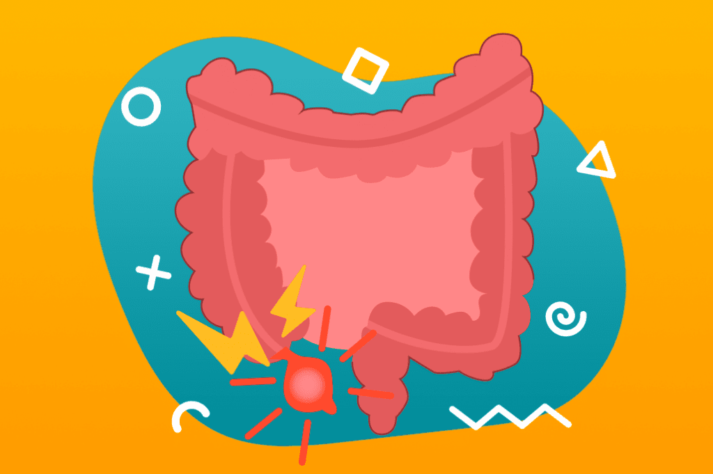 Cum se identifică apendicita: semne la copii și adulți - e-medicina.md